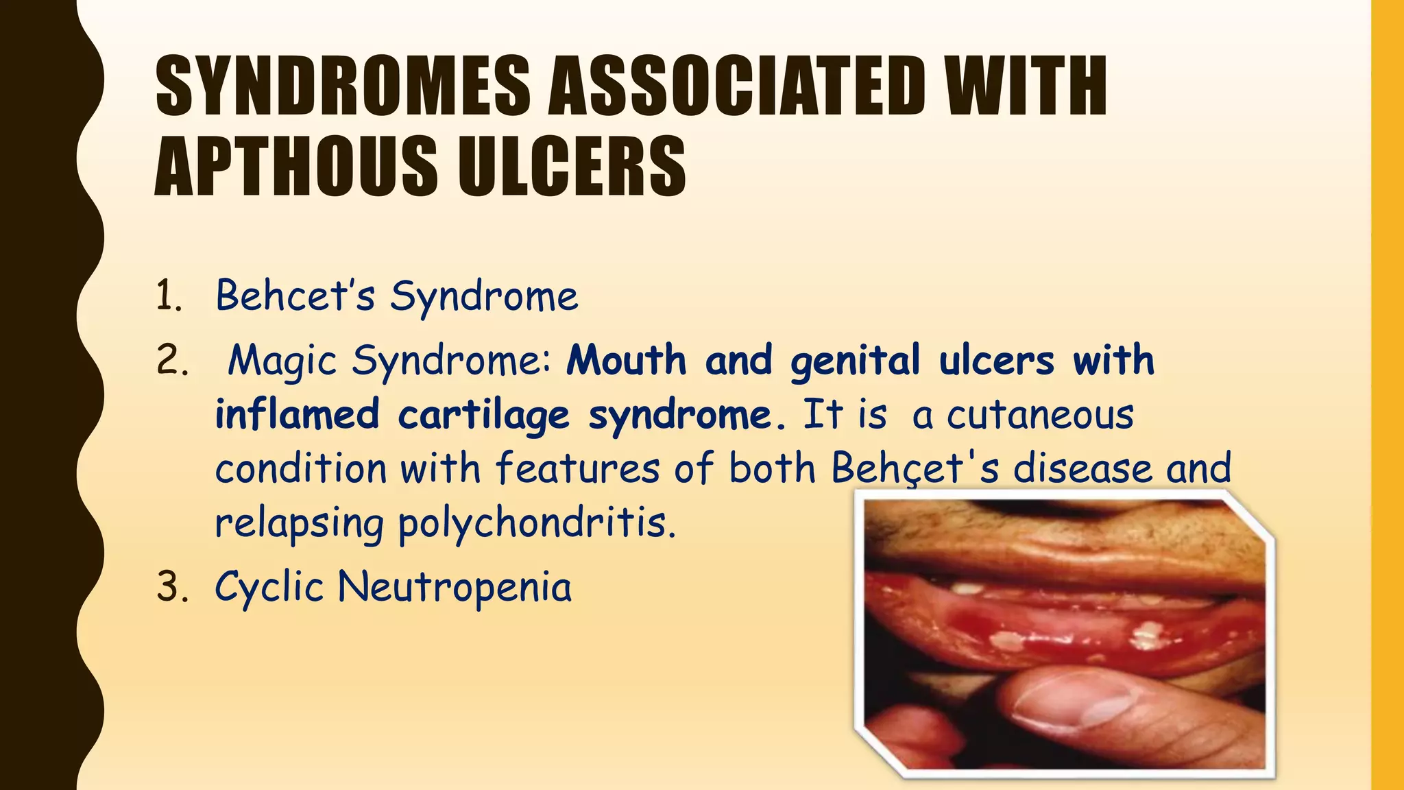 Aphthous ulcers | PPTX