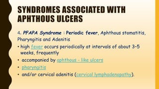 Aphthous ulcers | PPTX