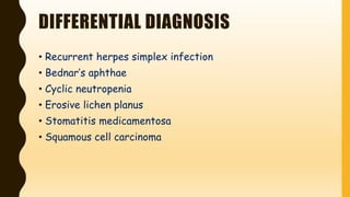 The Diagnosis And Management Of Recurrent Aphthous, 43% OFF