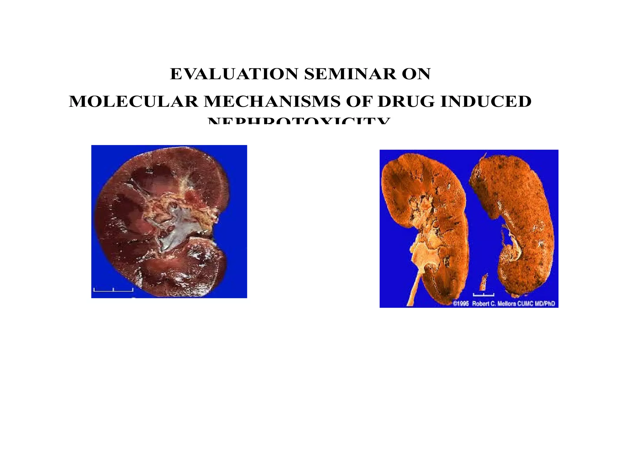 Molecular mechanism of drug induced nephrotoxicity | ODP