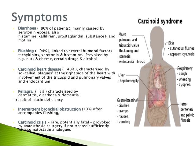 Apu domas & carcinoid syndrome