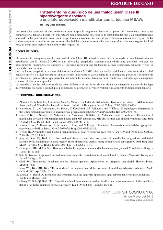 Tratamiento no quirurgico de una maloclusion clase III hiperdivergente ...