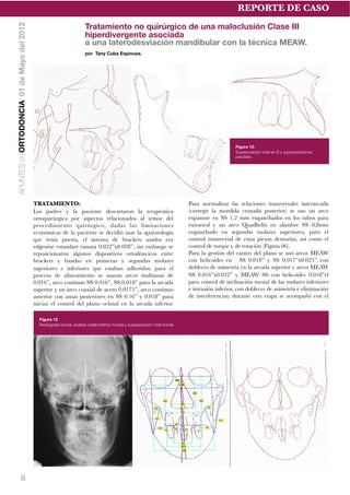 Tratamiento no quirurgico de una maloclusion clase III hiperdivergente ...