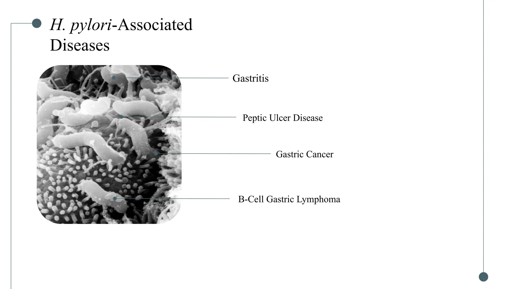 Diagnosis tests of Helicobacter pylori – PPT & pdf file | PPT