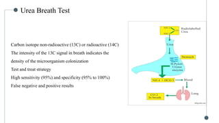 Diagnosis tests of Helicobacter pylori – PPT & pdf file | PPT