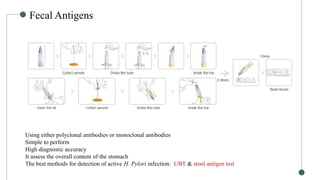 Diagnosis tests of Helicobacter pylori – PPT & pdf file | PPT