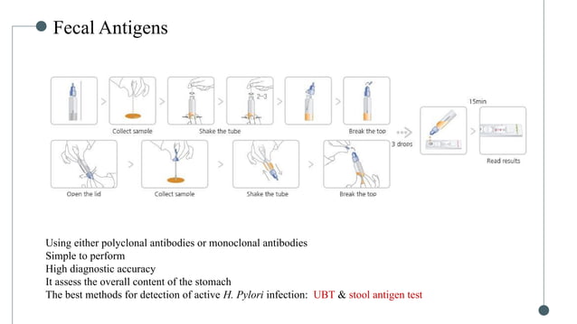 Diagnosis tests of Helicobacter pylori – PPT & pdf file | PPT
