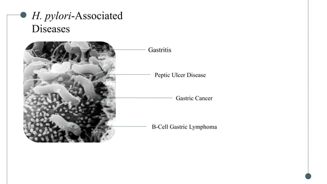 Diagnosis tests of Helicobacter pylori – PPT & pdf file | PPT