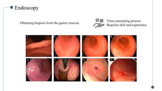 Diagnosis tests of Helicobacter pylori – PPT & pdf file | PPT