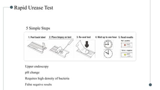 Diagnosis tests of Helicobacter pylori – PPT & pdf file | PPT