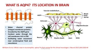 Neuromyelitis optica spectrum disorder -NMOSD : An AQP4 antibody ...