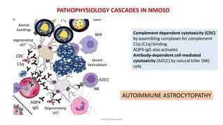Neuromyelitis optica spectrum disorder -NMOSD : An AQP4 antibody ...