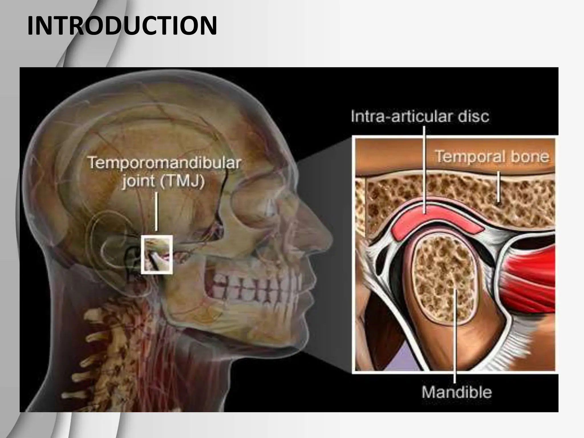 Aqua Splint universal therapy tmj orthodontics.pptx