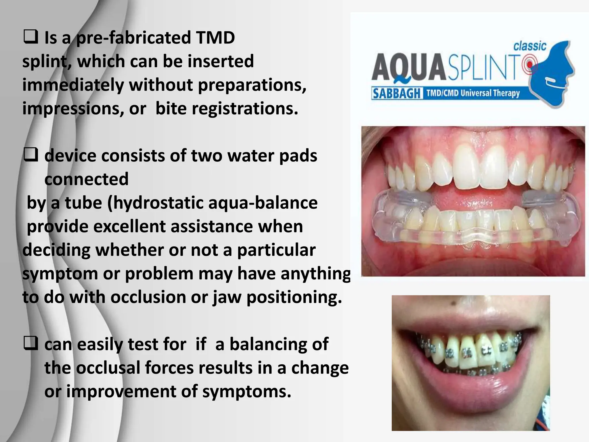 Aqua Splint universal therapy tmj orthodontics.pptx