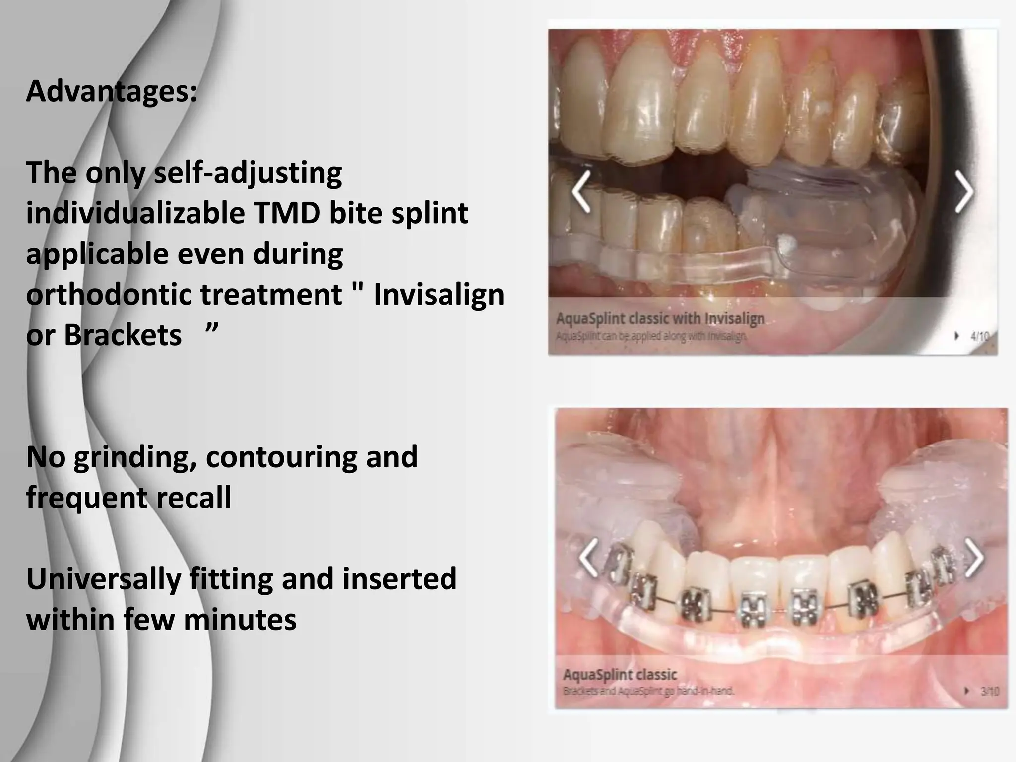 Aqua Splint universal therapy tmj orthodontics.pptx