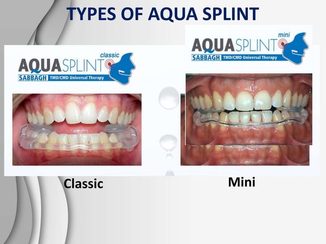 Aqua Splint universal therapy tmj orthodontics.pptx