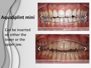 Aqua Splint universal therapy tmj orthodontics.pptx