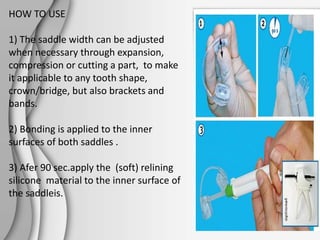 Aqua Splint universal therapy tmj orthodontics.pptx
