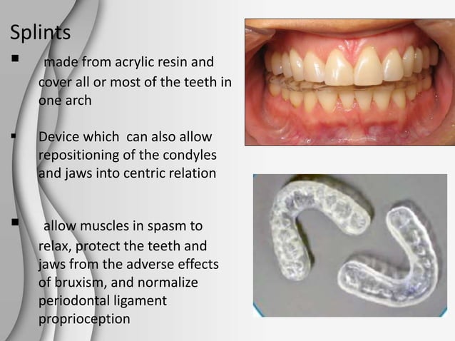 Aqua Splint universal therapy tmj orthodontics.pptx