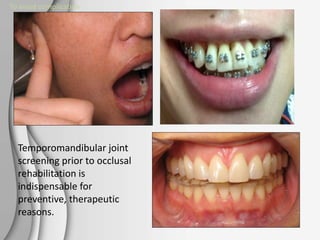 Aqua Splint universal therapy tmj orthodontics.pptx