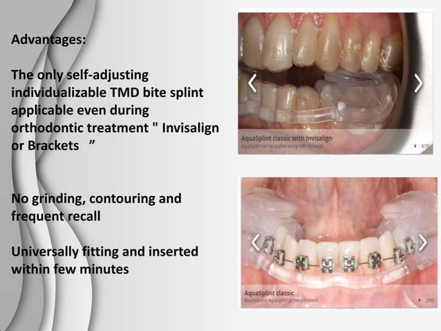 Aqua Splint universal therapy tmj orthodontics.pptx
