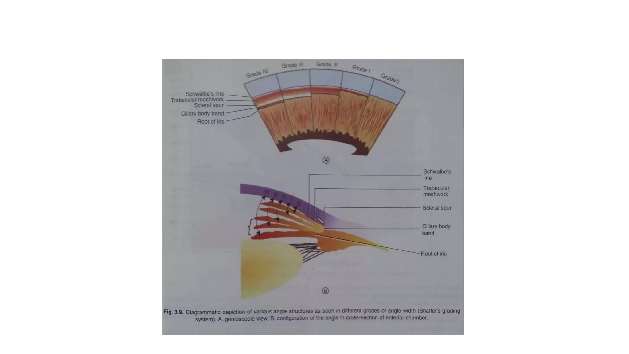 Aqueous humor ,IOP.pptx
