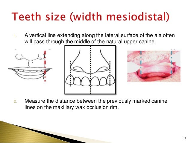 selecting artificial tooth