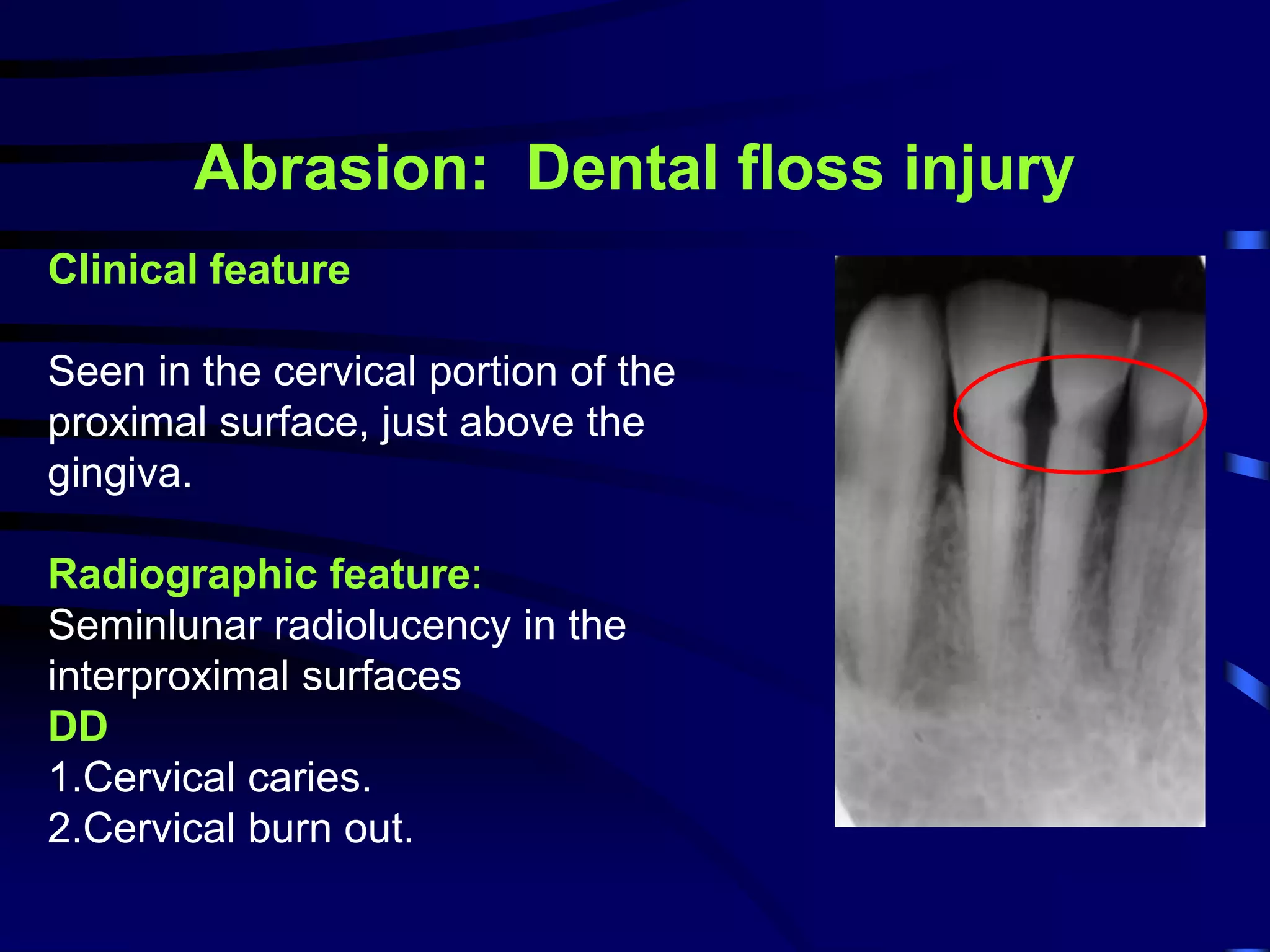 Acquired abnormalities of the jaws | PPT
