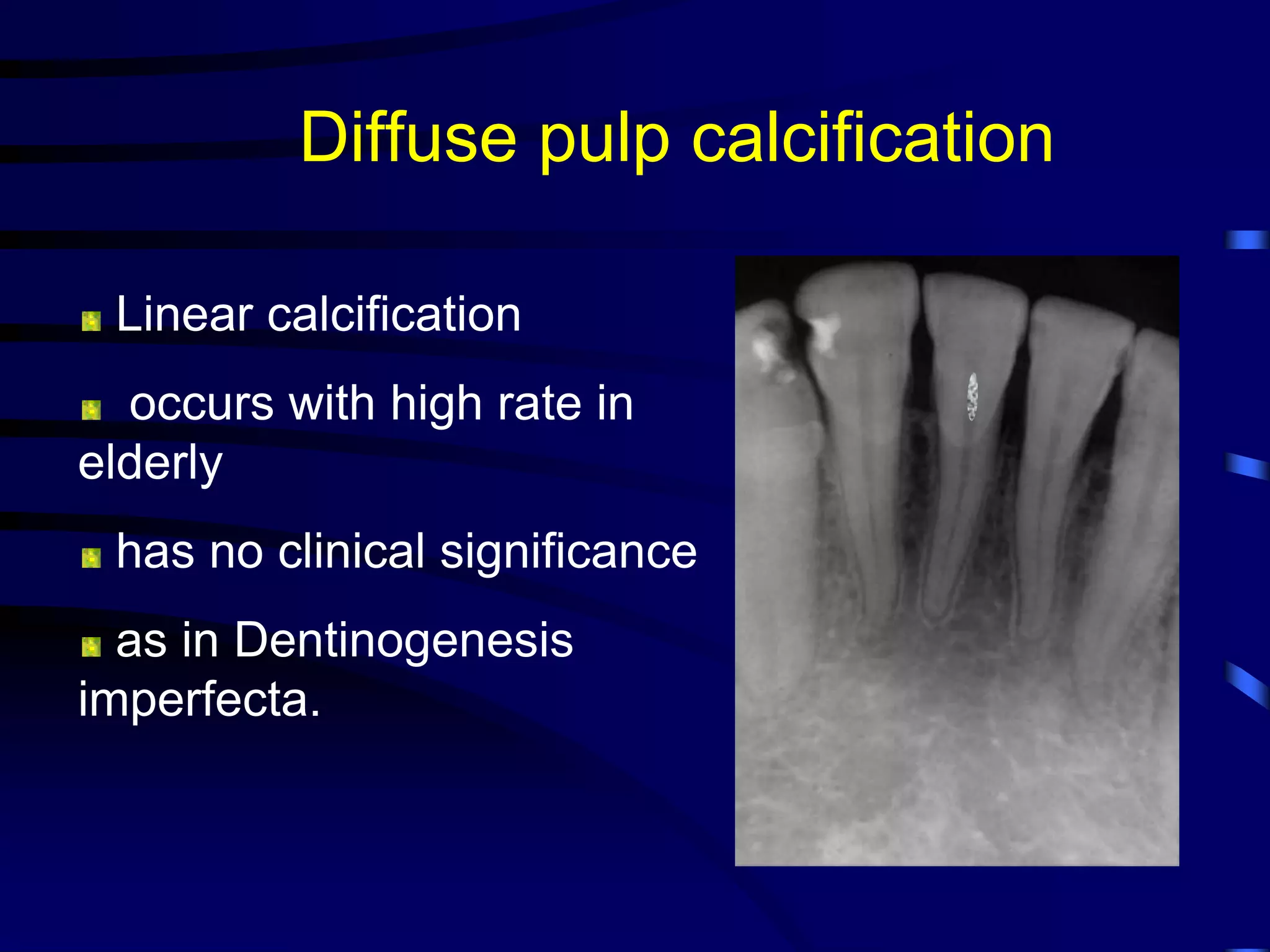Acquired abnormalities of the jaws | PPT