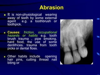 Acquired abnormalities of the jaws | PPT