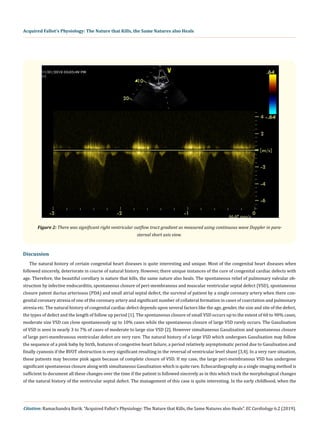 Acquired Fallot's physiology | PDF