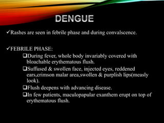 Approach to a child with fever and rash | PPTX