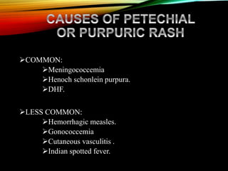Approach to a child with fever and rash | PPTX