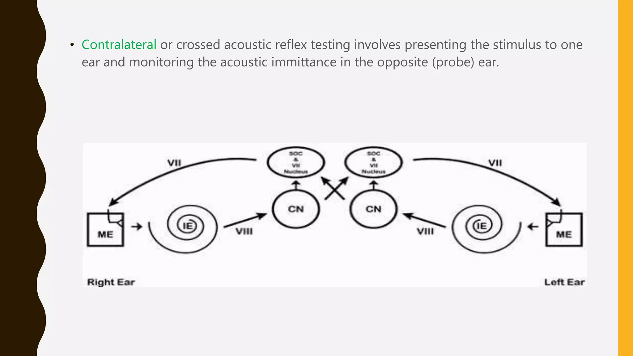 Acoustic Reflex (AR) and Tone decay (TDT) | PPTX