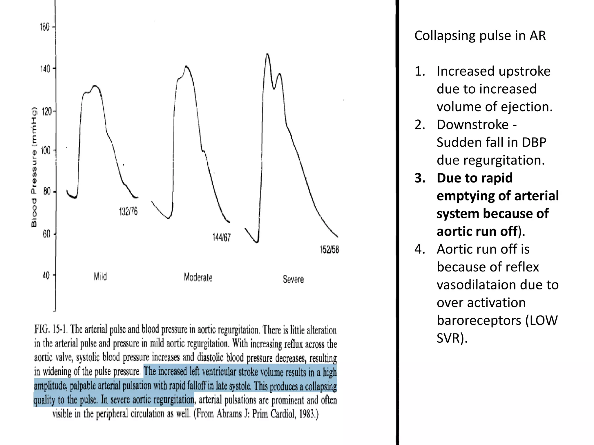 Pathophysiology of aortic regurgitation and management | PPTX