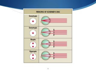 Automatic Refractometer and it's principles | PPTX