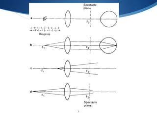 Automatic Refractometer and it's principles | PPTX