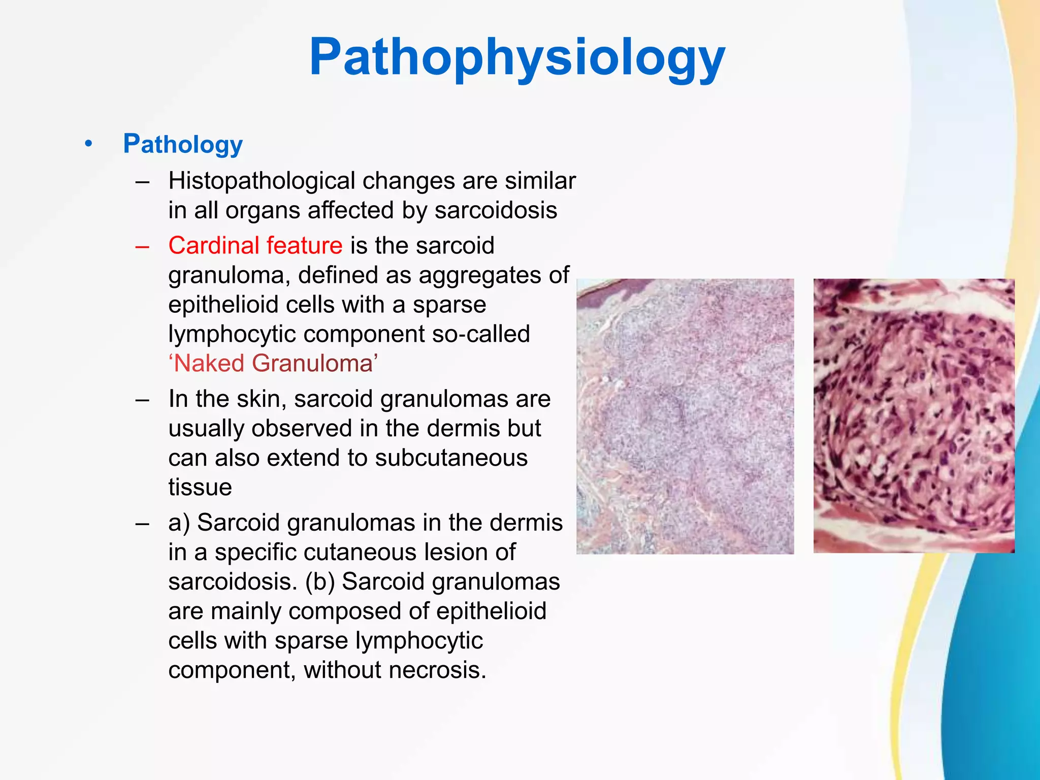 A RARE CASE OF THE GREAT IMITATOR IN DERMATOLOGY-SARCOIDOSIS.pptx