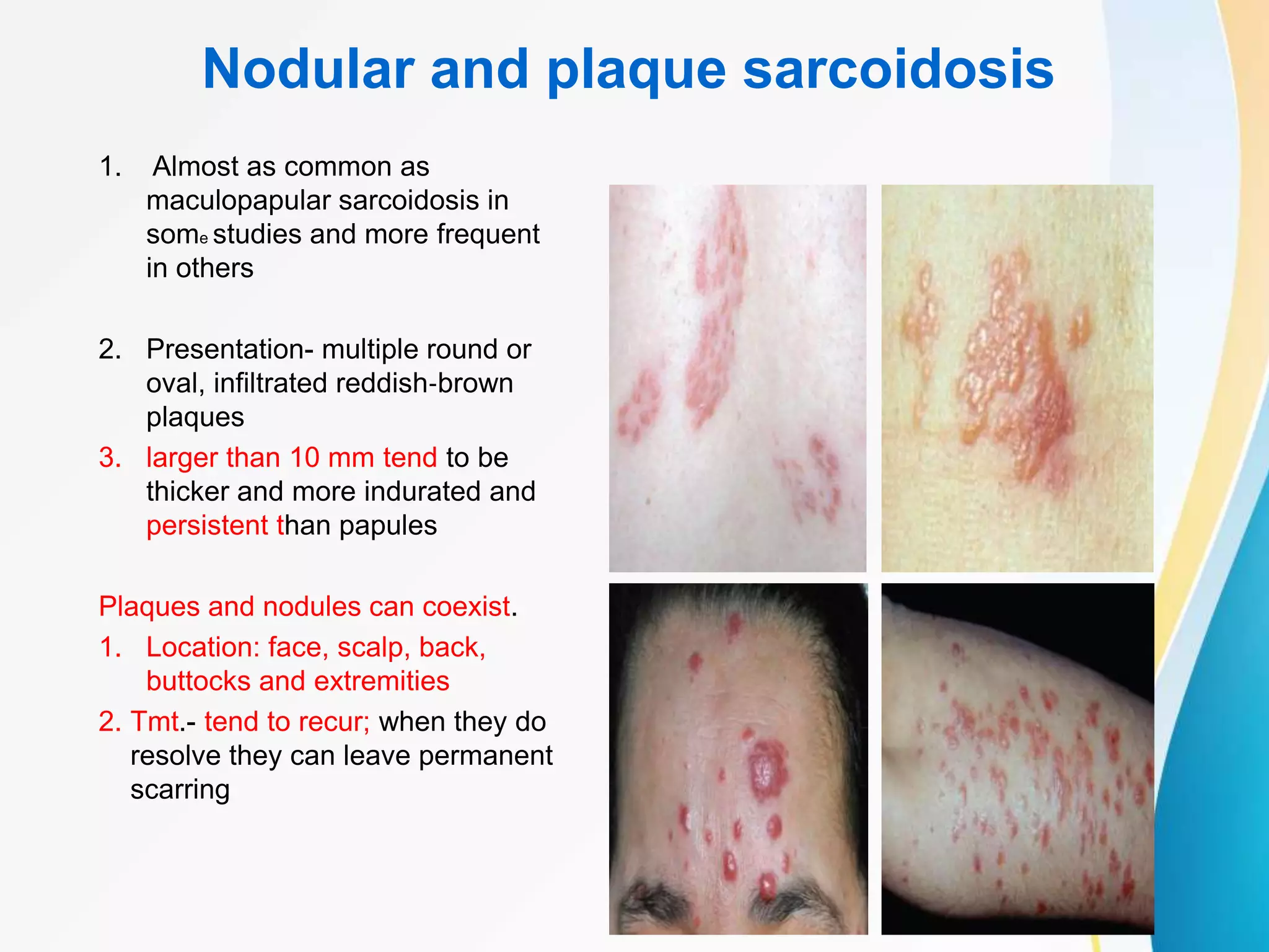 A RARE CASE OF THE GREAT IMITATOR IN DERMATOLOGY-SARCOIDOSIS.pptx