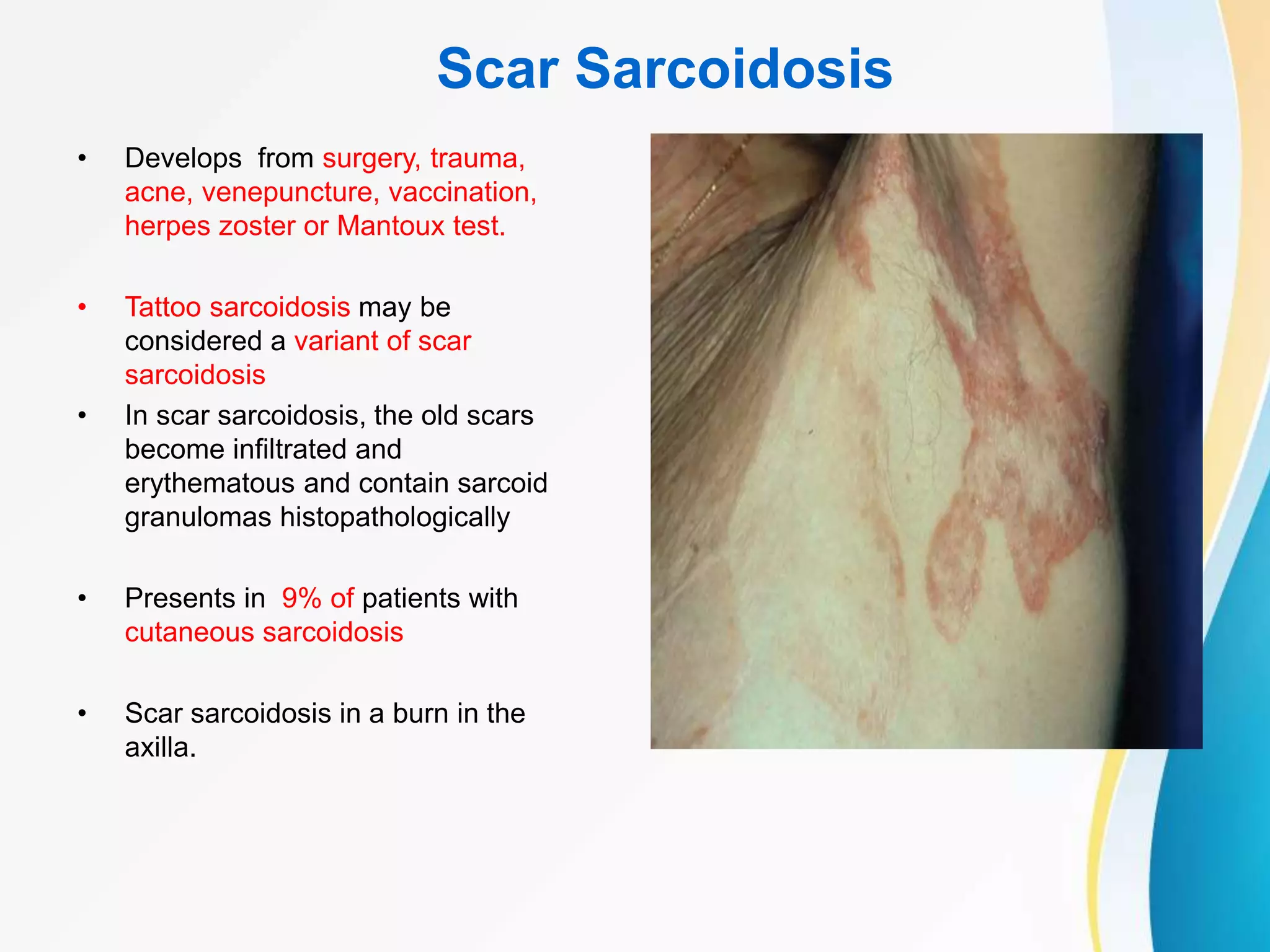 A RARE CASE OF THE GREAT IMITATOR IN DERMATOLOGY-SARCOIDOSIS.pptx