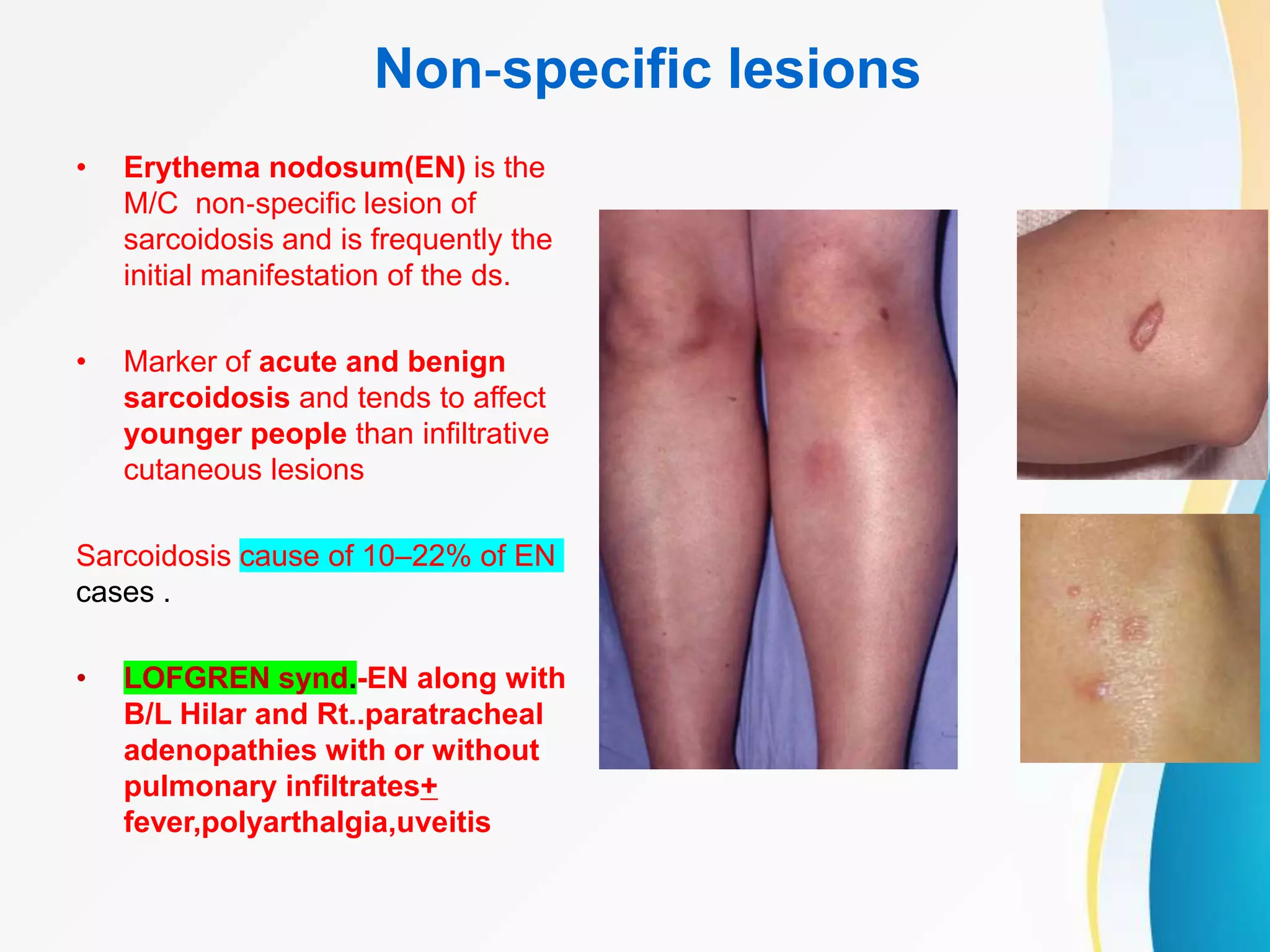 A RARE CASE OF THE GREAT IMITATOR IN DERMATOLOGY-SARCOIDOSIS.pptx