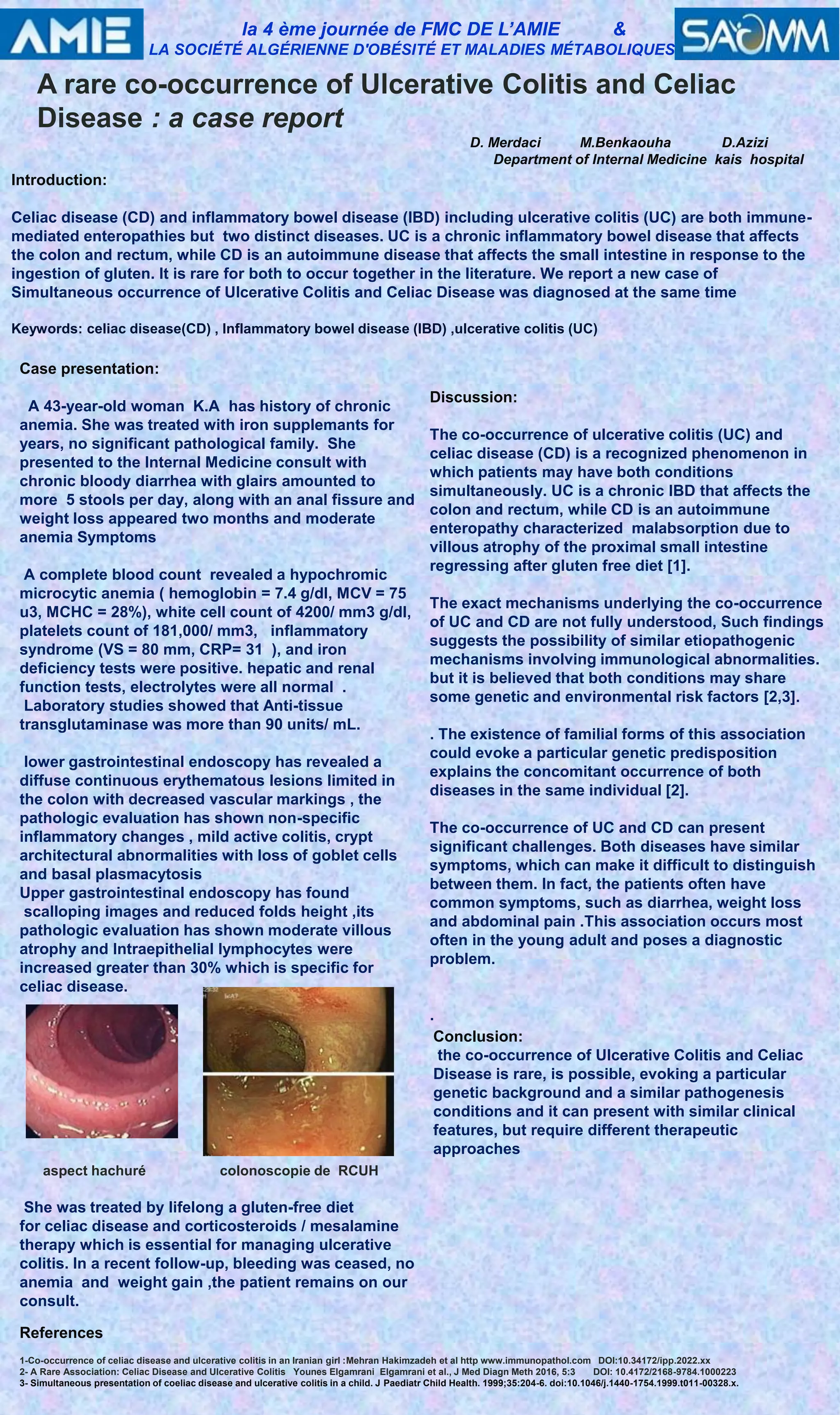 A rare co-occurrence of Ulcerative Colitis and Celiac Disease.pdf