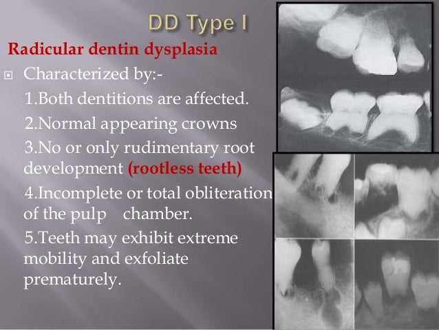 A rare condition affecting the primary and permanent by dr ibrahim