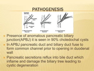 Choledochal cyst | PPTX