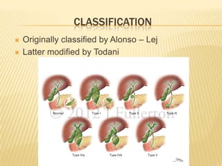 Choledochal cyst | PPTX