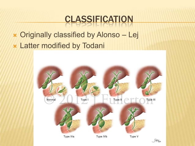 Choledochal cyst | PPTX | Digestive Disorders | Diseases and Conditions
