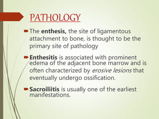 ANKYLOSING SPONDYLITIS physiotherapy ppt | PPTX