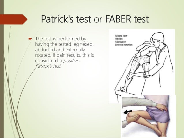 ANKYLOSING SPONDYLITIS physiotherapy ppt