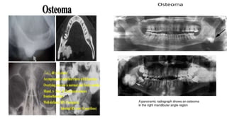RADIOLOGY OF TEETH AND JAWS | PPTX