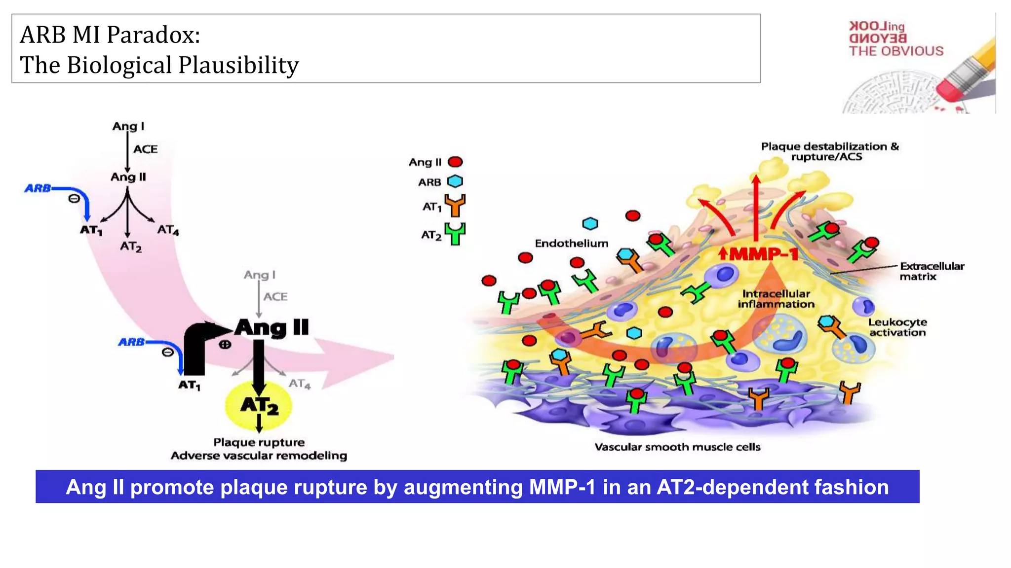 ARB MI PARADOX-1.pptx